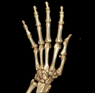 TC Mano – muñeca | Centro Médico Teknon